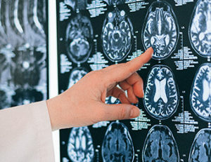 Medical Treatment – MREA